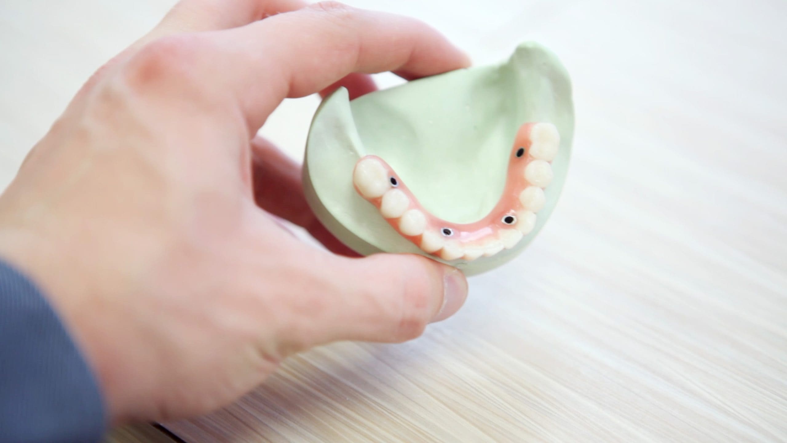 How Dental Bridge Can Help You: What You Need to Know